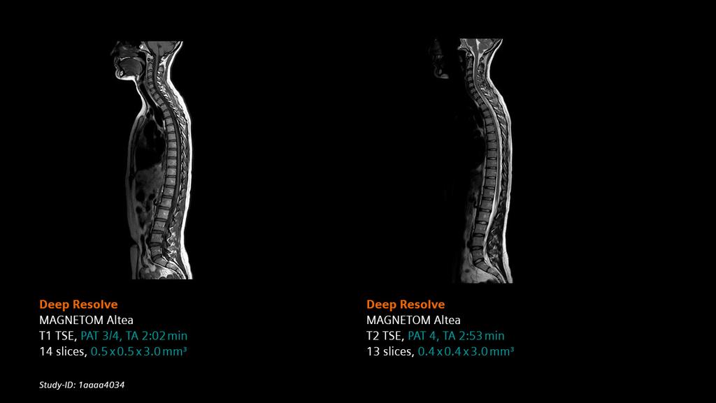 Deep Resolve - Siemens Healthineers