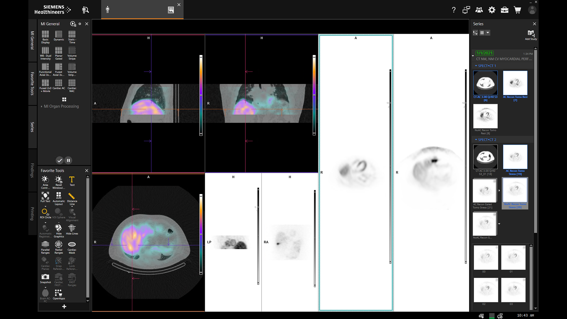 syngo.via - Siemens Healthineers USA