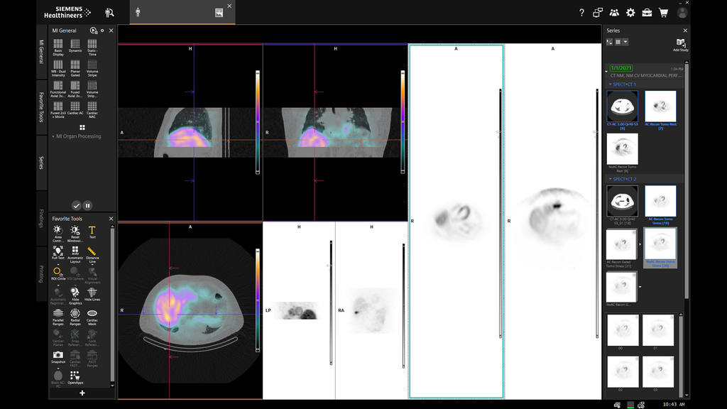 syngo.via - Siemens Healthineers USA