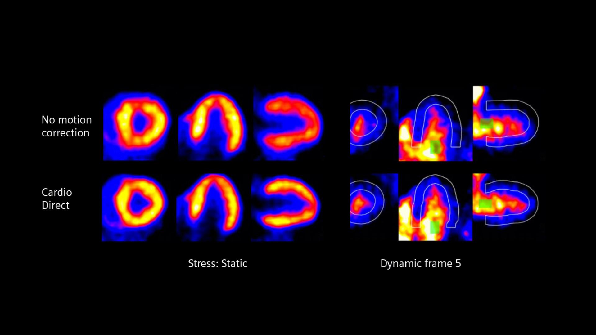Biograph Trinion PET/CT scanner - Siemens Healthineers