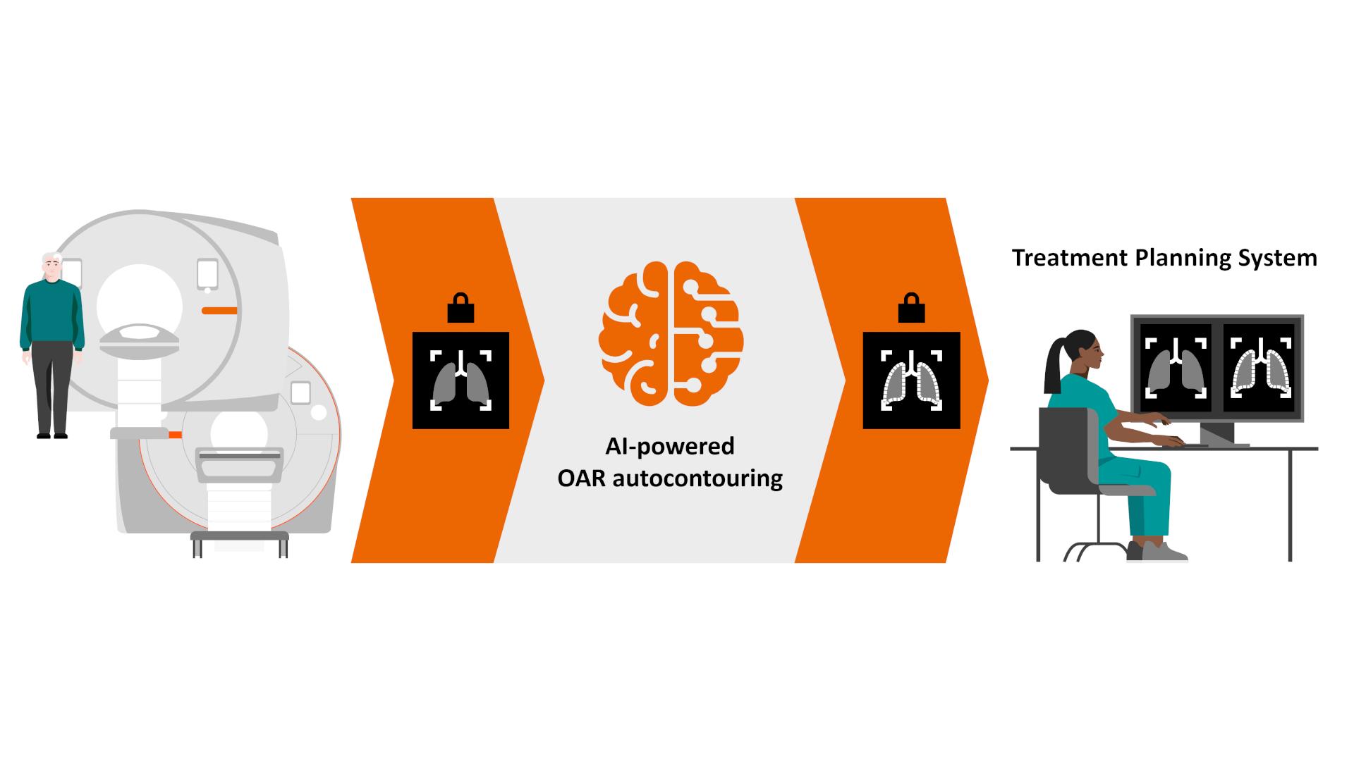 Autocontouring in radiation therapy - Siemens Healthineers - Siemens ...