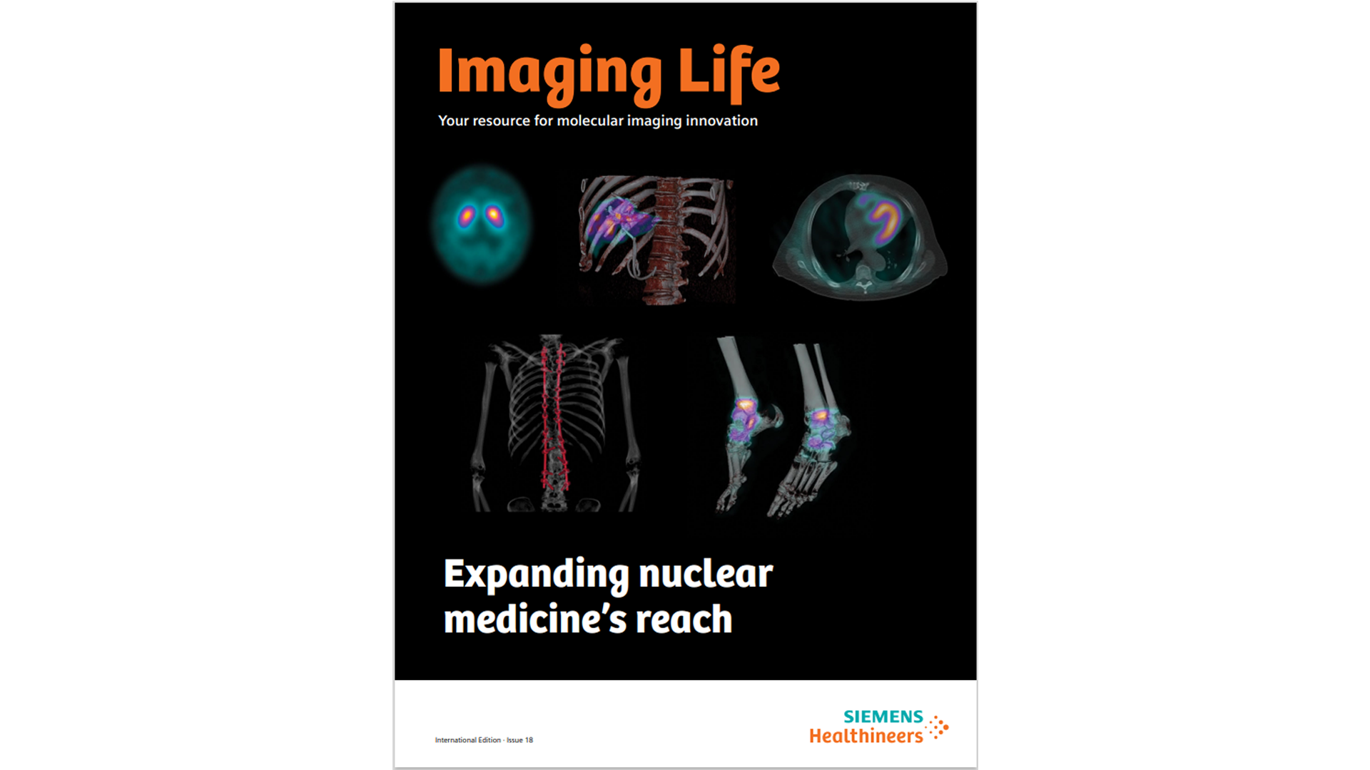 Imaging Life Issue 18 - Siemens Healthineers
