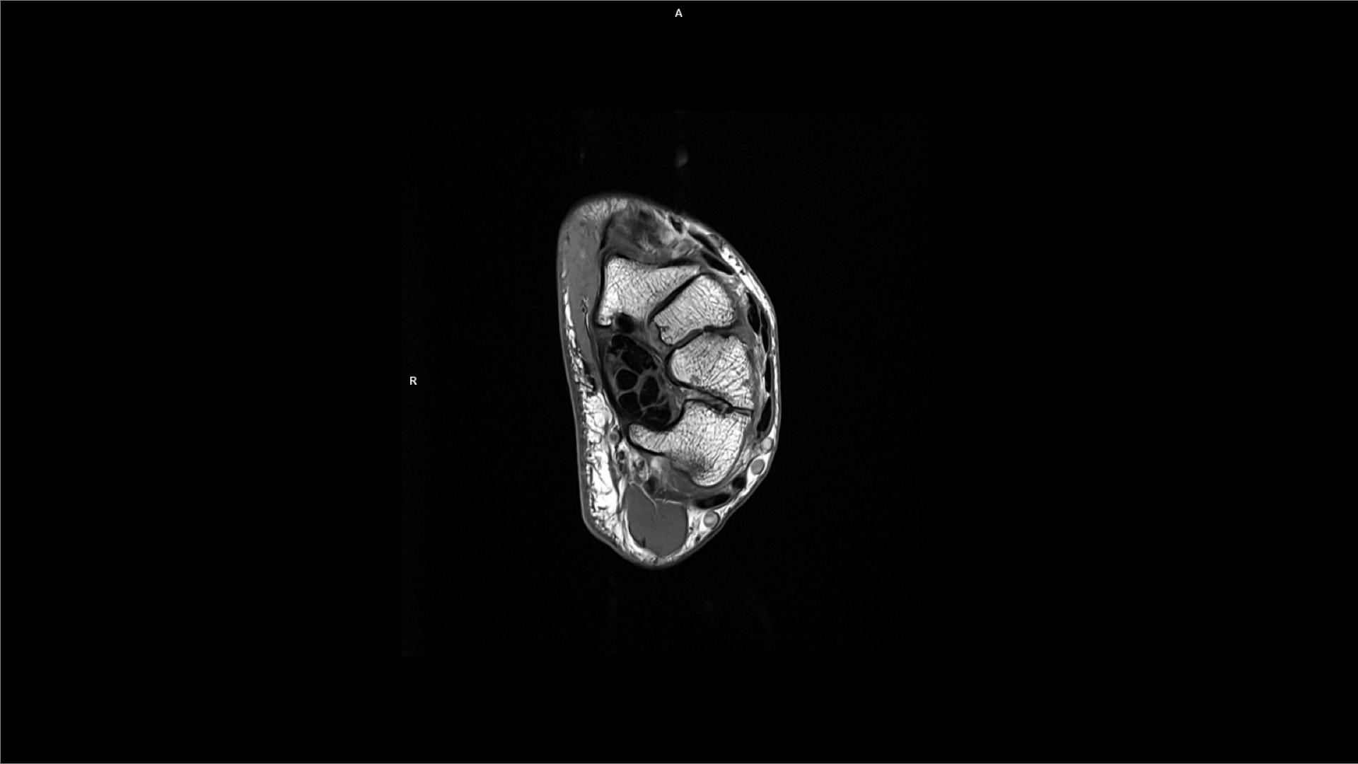 t1_tse_tra_p4_DRB_DRS-MAGNETOM Sola - Siemens Healthineers USA