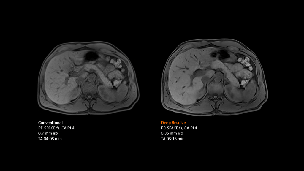 MAGNETOM Altea - Siemens Healthineers