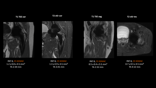 Musculoskeletal Imaging - Siemens Healthineers USA