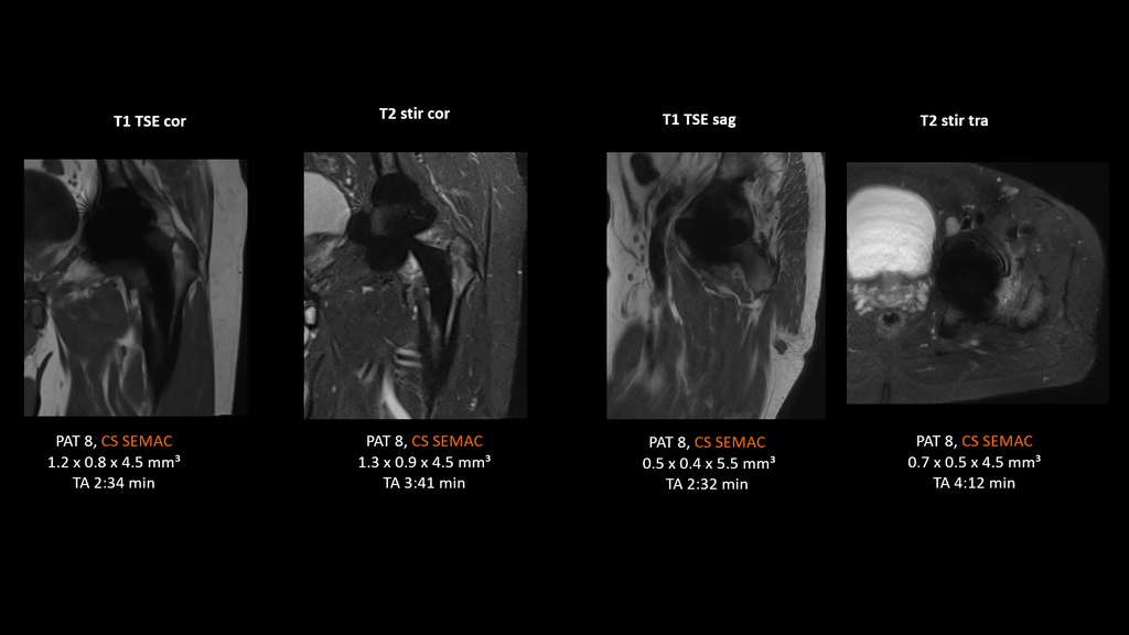 Musculoskeletal Imaging - Siemens Healthineers