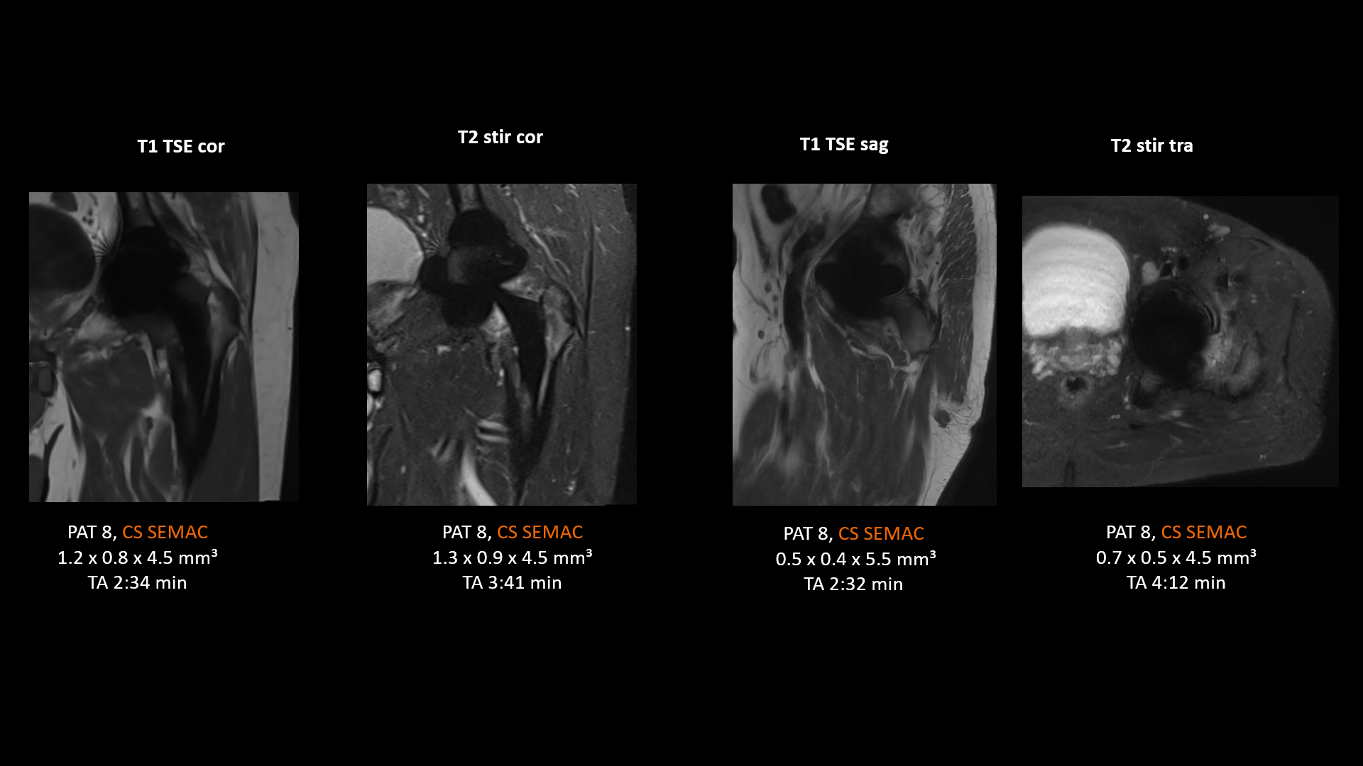 Musculoskeletal Imaging - Siemens Healthineers