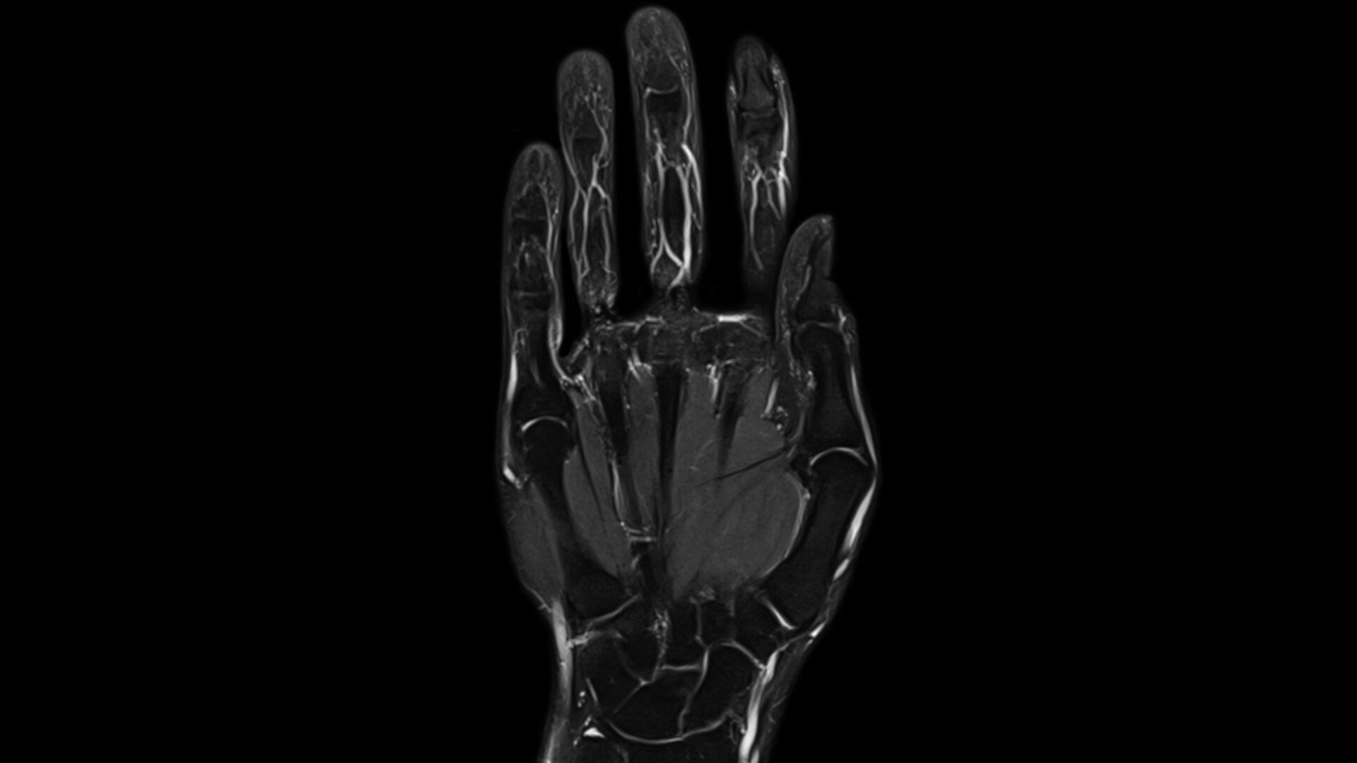 MAGNETOM Aera - Siemens Healthineers USA