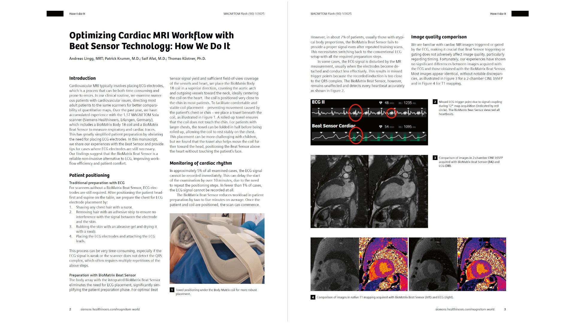 BioMatrix Beat Sensor