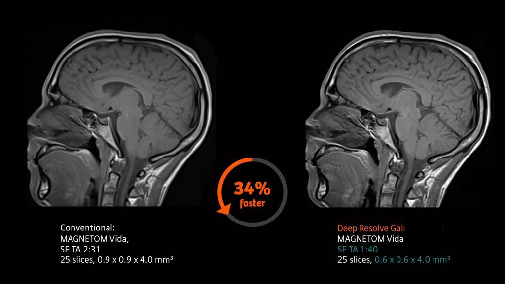 Deep Resolve - Siemens Healthineers USA