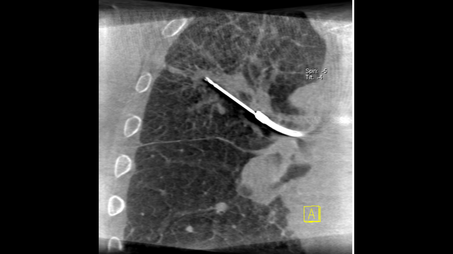 Lung Care Imaging Solutions - Siemens Healthineers USA
