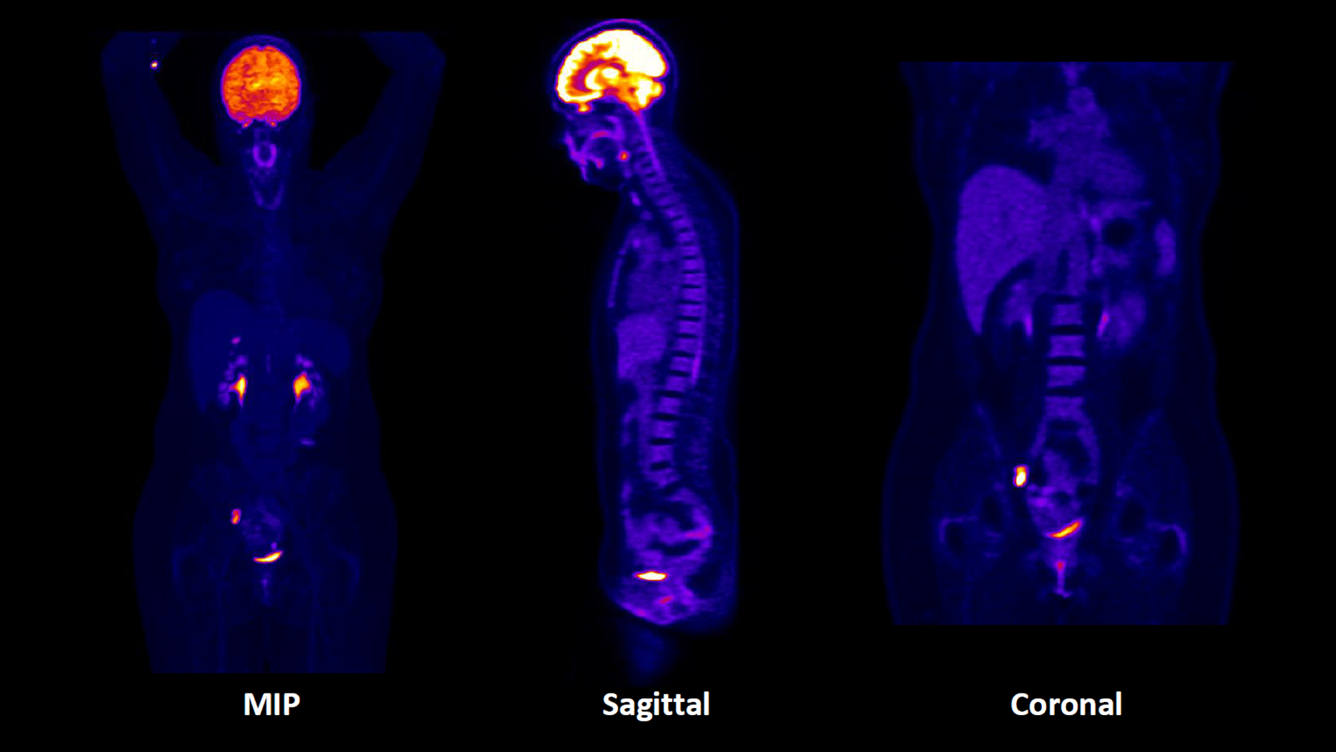 Biograph Vision PET/CT Scanner - Siemens Healthineers