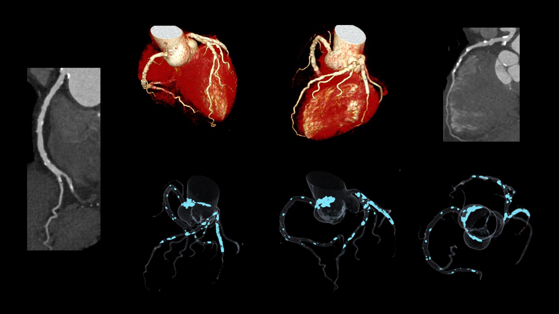 SOMATOM Drive - Siemens Healthineers USA