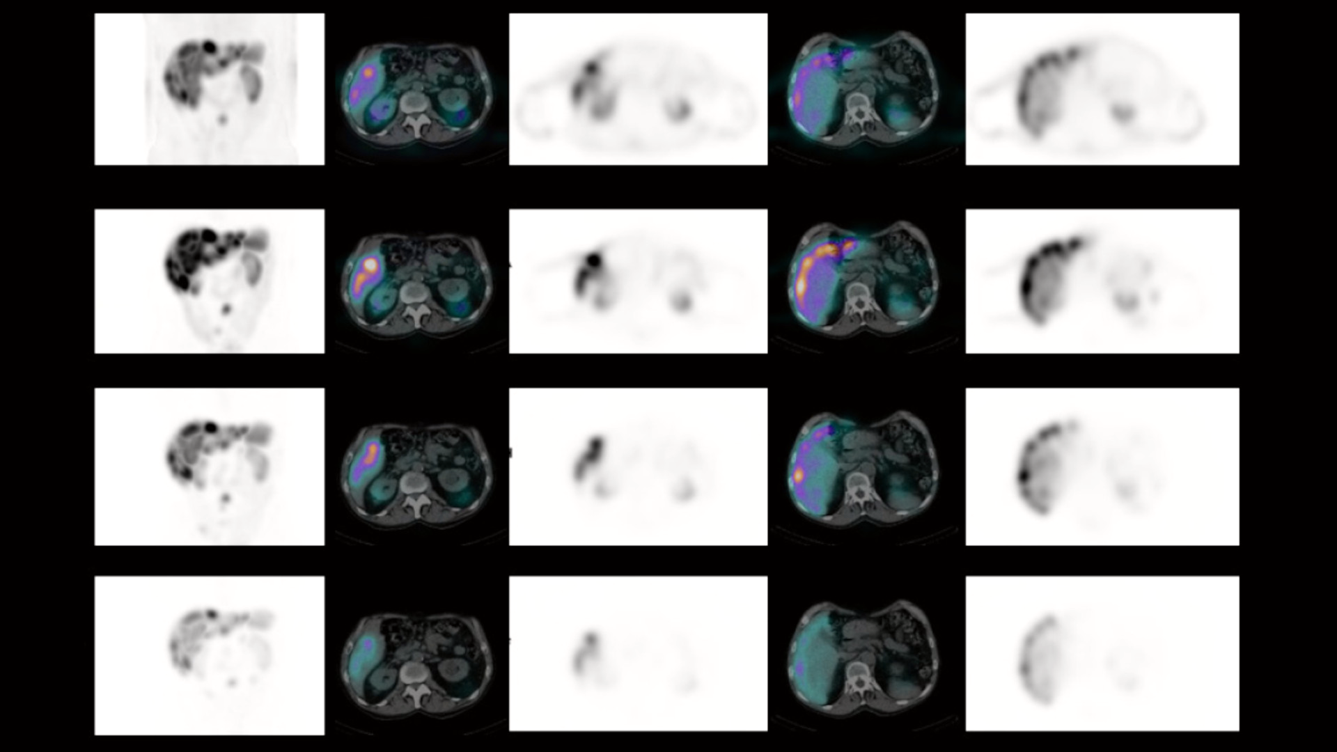Molecular Imaging - Siemens Healthineers