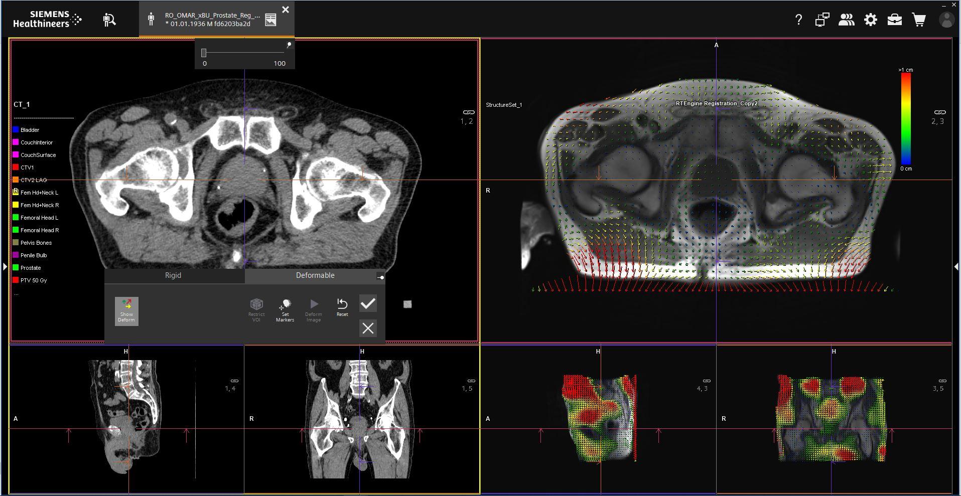 syngo.via RT Image Suite - Siemens Healthineers