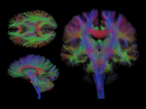 Magnetic Resonance Imaging - Siemens Healthineers
