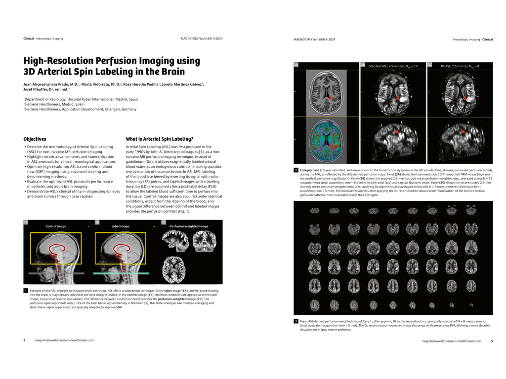 Arterial Spin Labeling