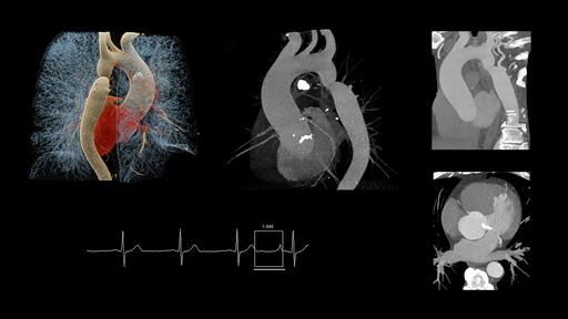 SOMATOM Drive eco – CT Scanner - Siemens Healthineers