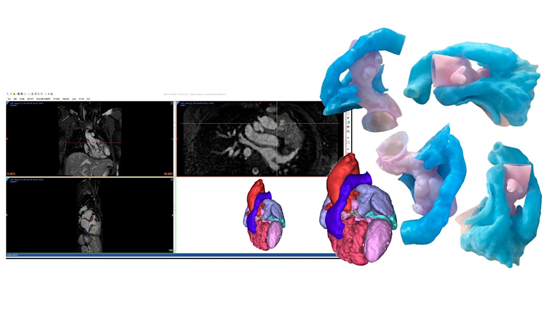 3D Whole Heart Imaging