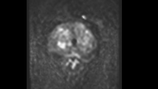 ZOOMitPRO - Siemens Healthineers USA