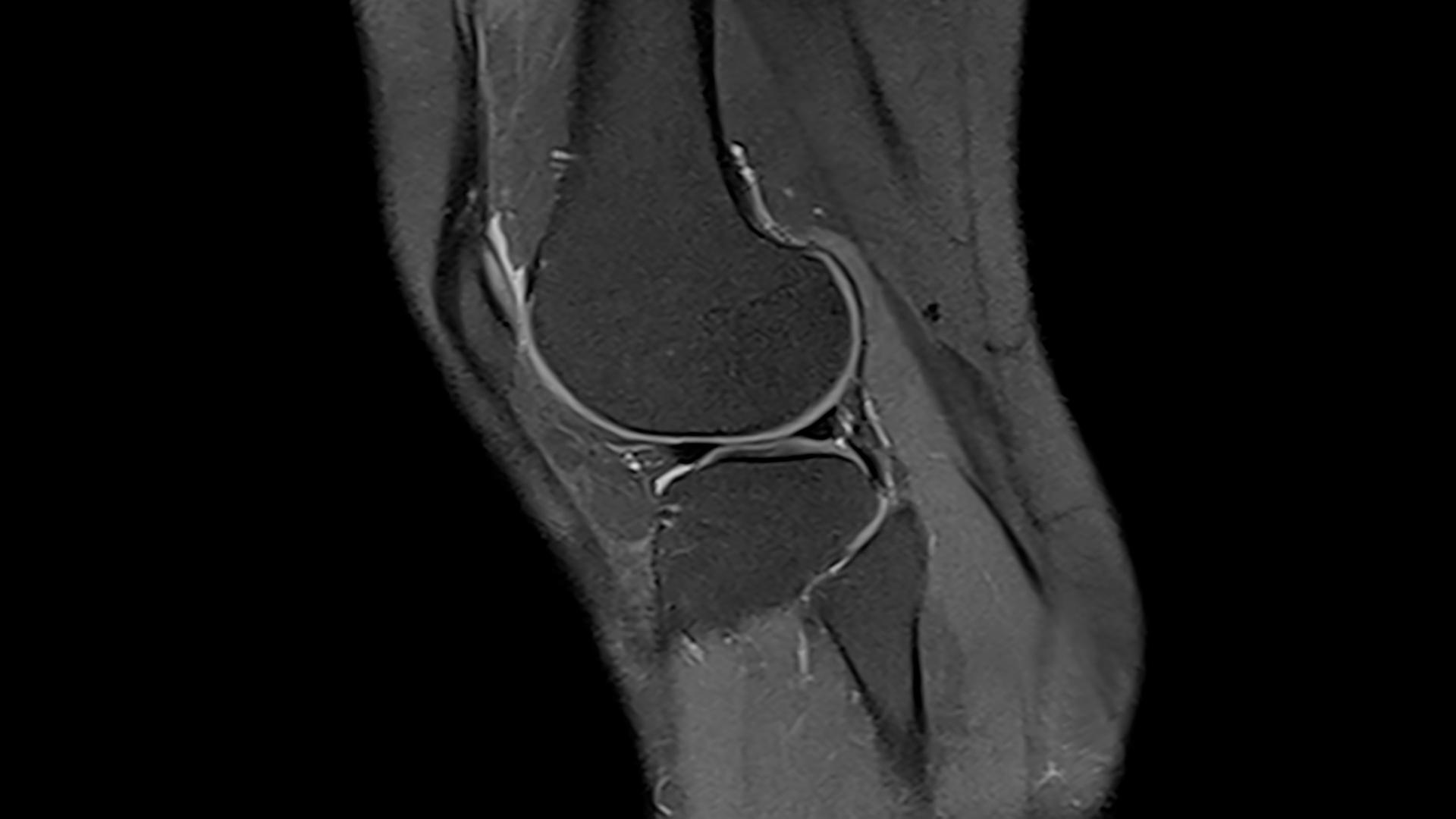 MAGNETOM Free.Max – Open Bore MRI - Siemens Healthineers USA