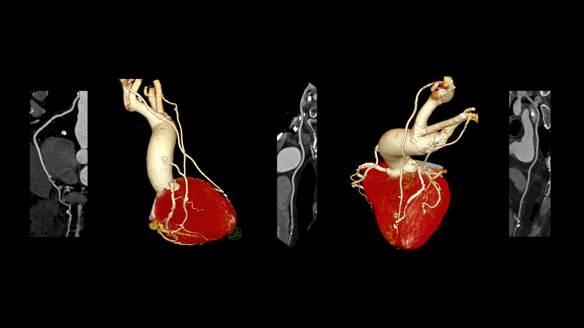 SOMATOM Drive - Siemens Healthineers USA