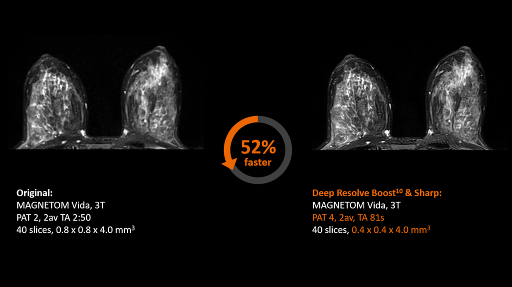 MAGNETOM Vida - Siemens Healthineers USA