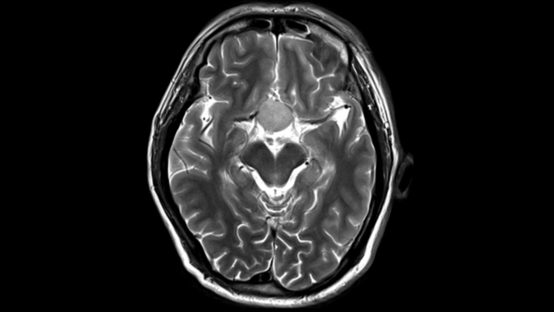 The MRI at 50 – what lies ahead?