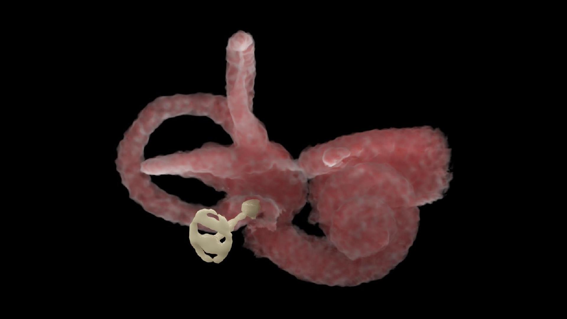 Computed Tomography - Siemens Healthineers USA