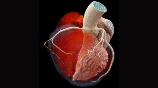 ACC.25 - Siemens Healthineers USA