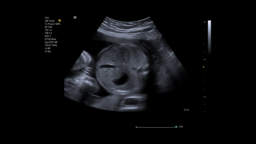 ACUSON Juniper is a High-Performance Shared Service Ultrasound System ...