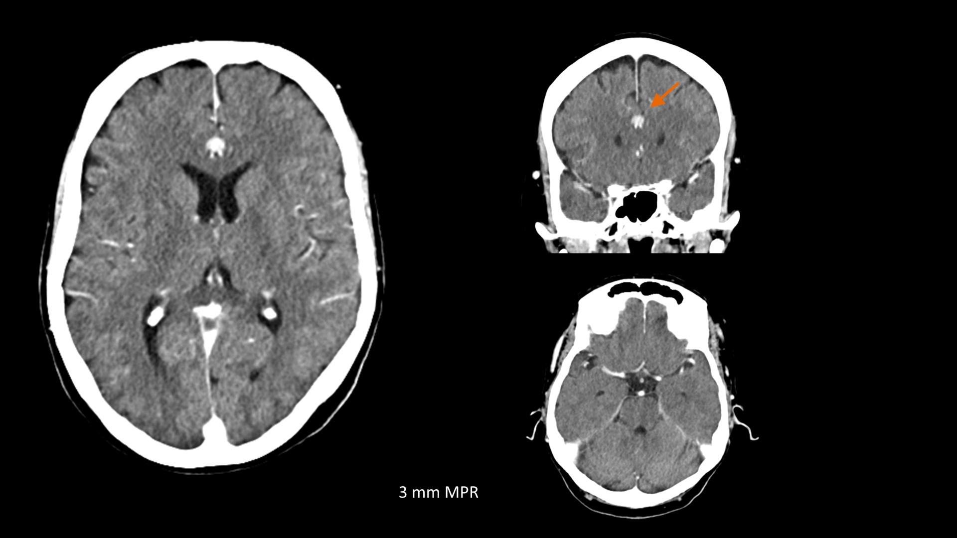 SOMATOM go.Up – Made to match - Siemens Healthineers USA
