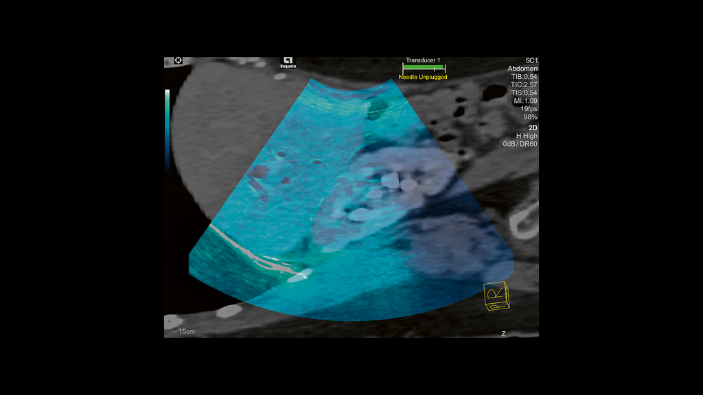 ACUSON Sequoia Ultrasound System