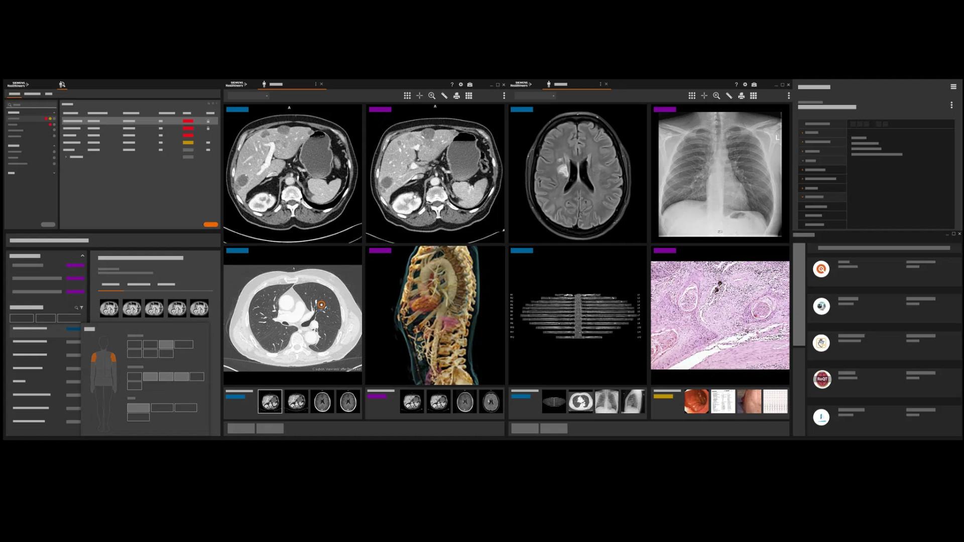 Advancing intelligence, empowering decisions - Siemens Healthineers
