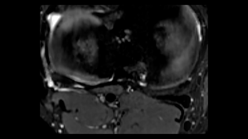 Phoenix Images for MAGNETOM Sola 1.5T