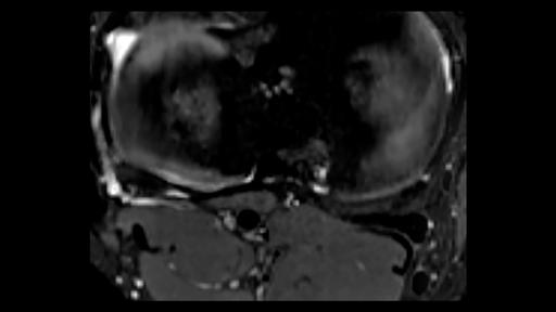 Phoenix Images for MAGNETOM Sola 1.5T