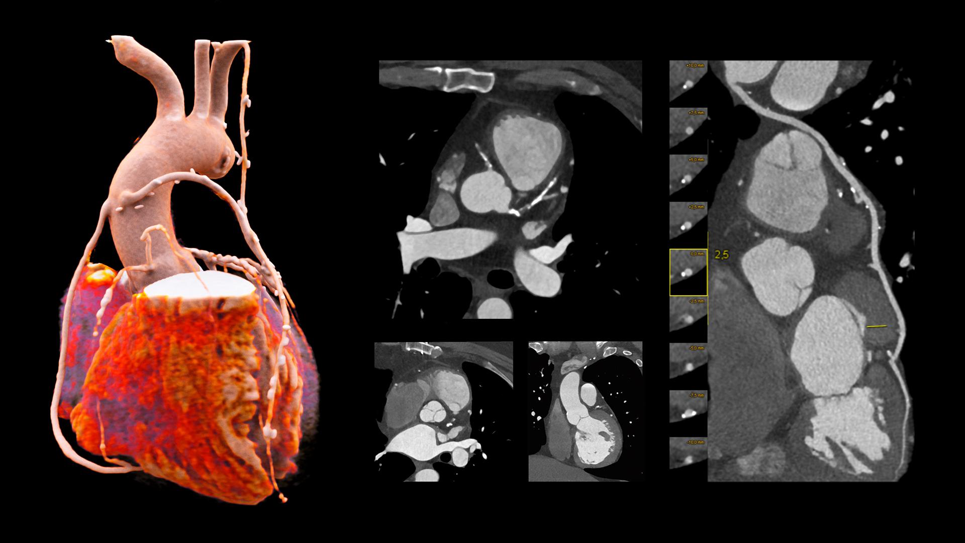 The SOMATOM X. platform – Intelligent imaging - Siemens Healthineers USA