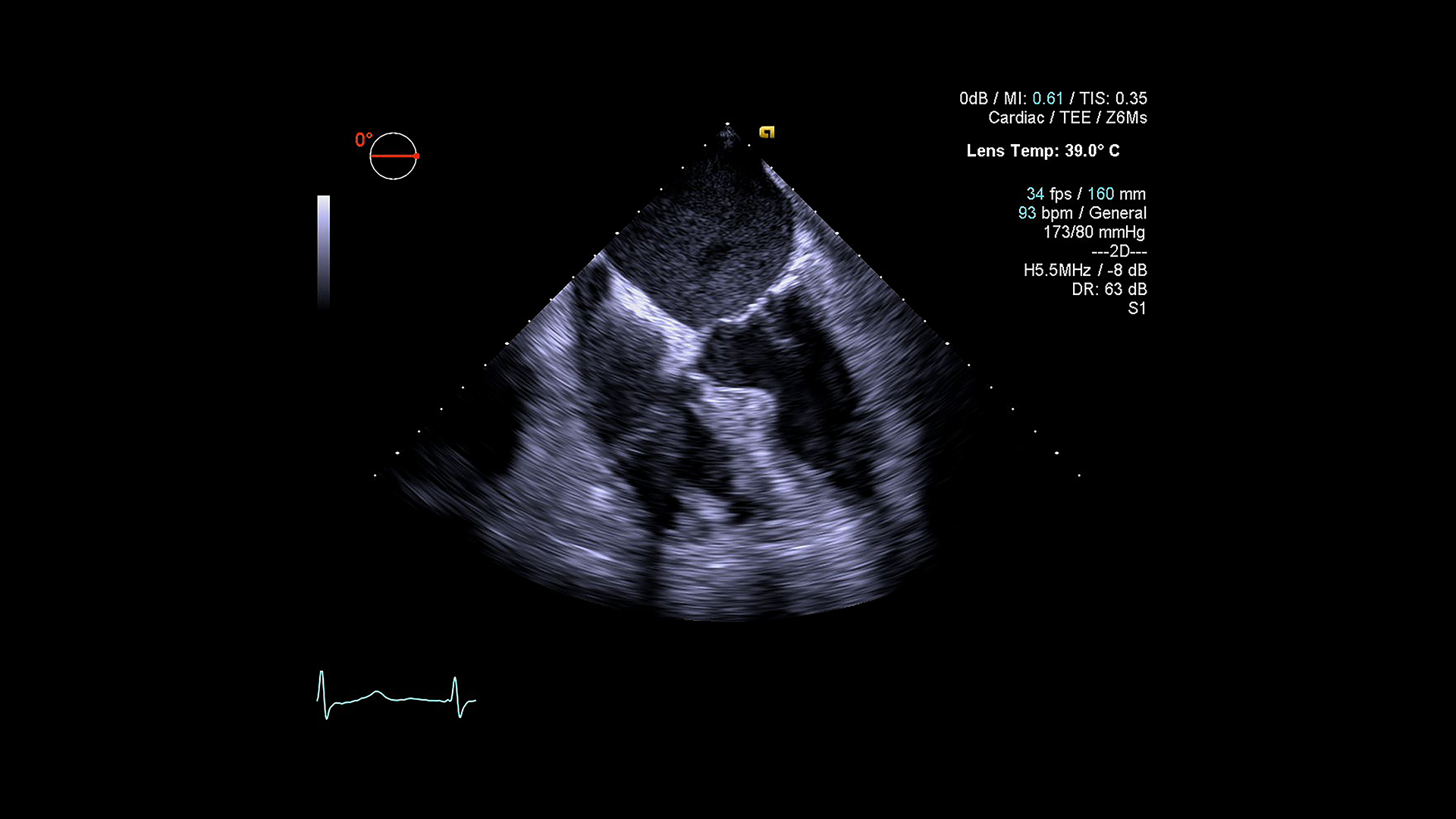 Cardiovascular Ultrasound | ACUSON SC2000 Ultrasound System - Siemens ...