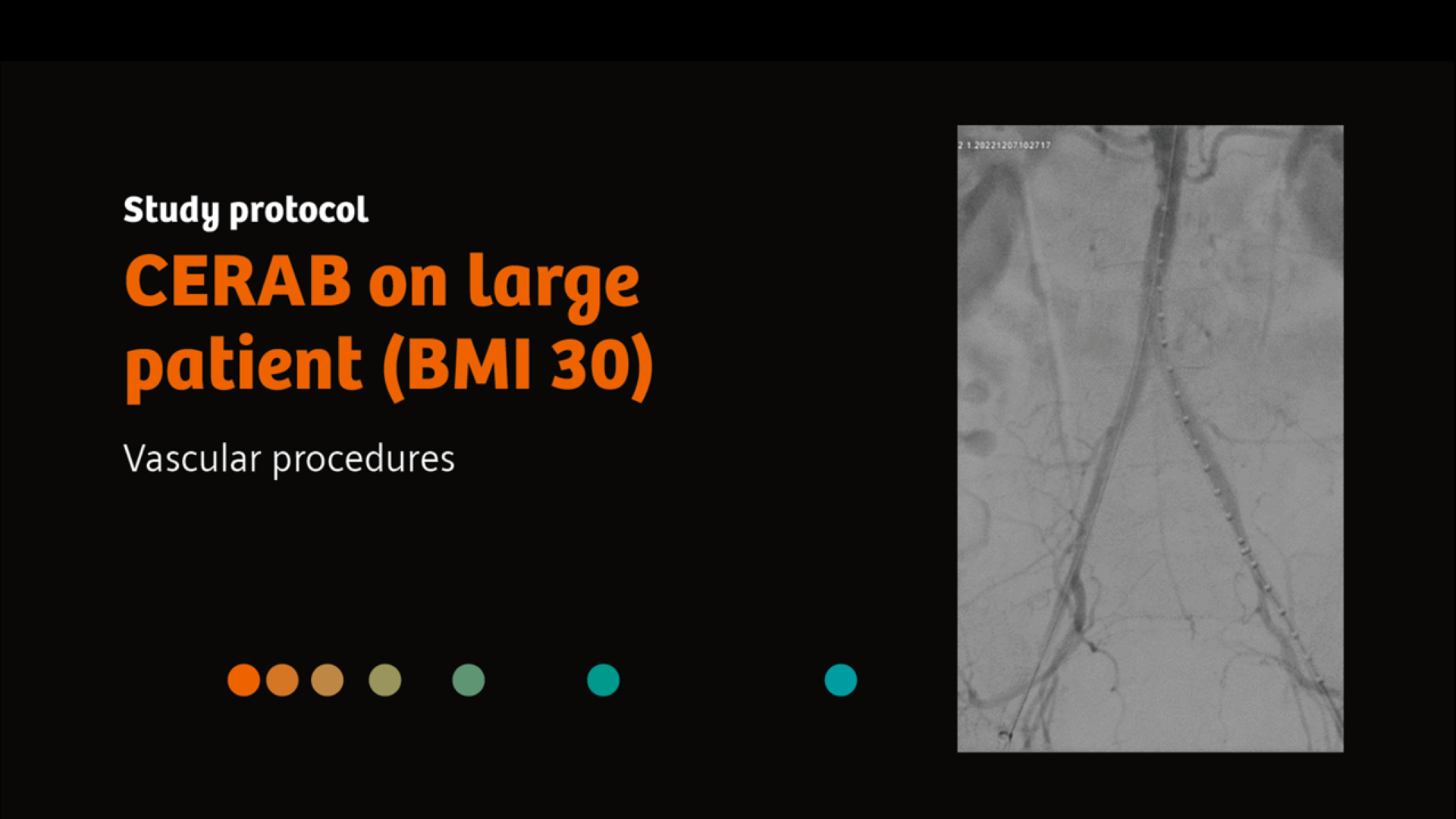Endovascular aortic procedures and peripheral artery disease - Siemens ...