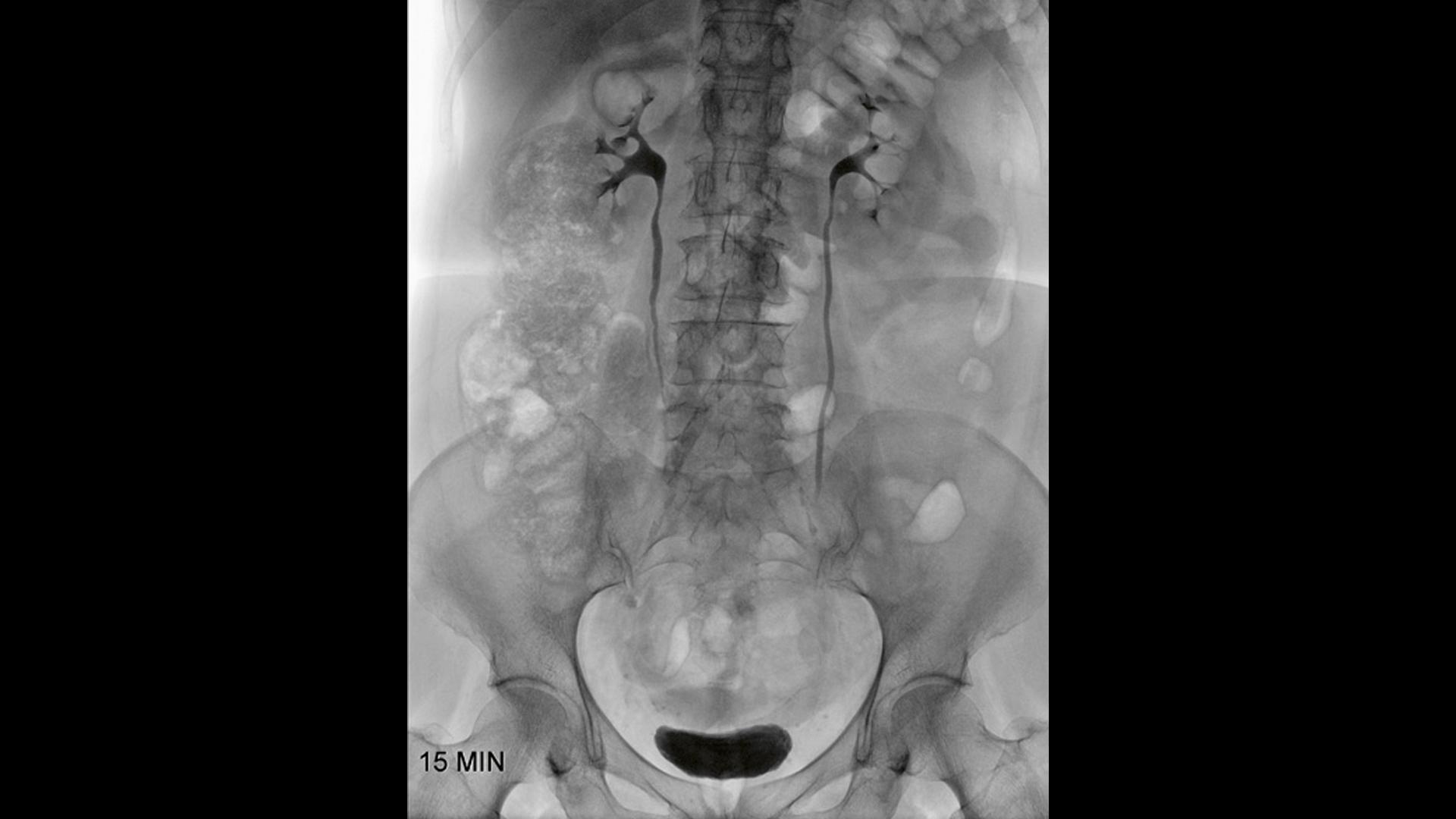Urology device Uroskop Omnia Max - Siemens Healthineers USA