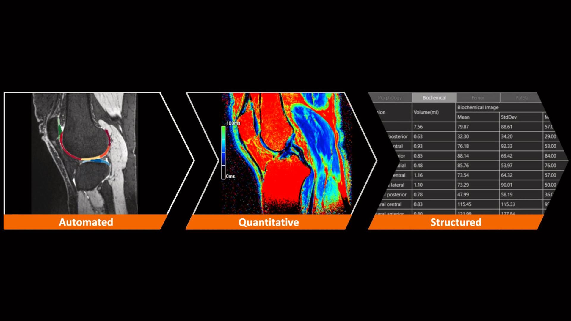 Musculoskeletal Imaging - Siemens Healthineers