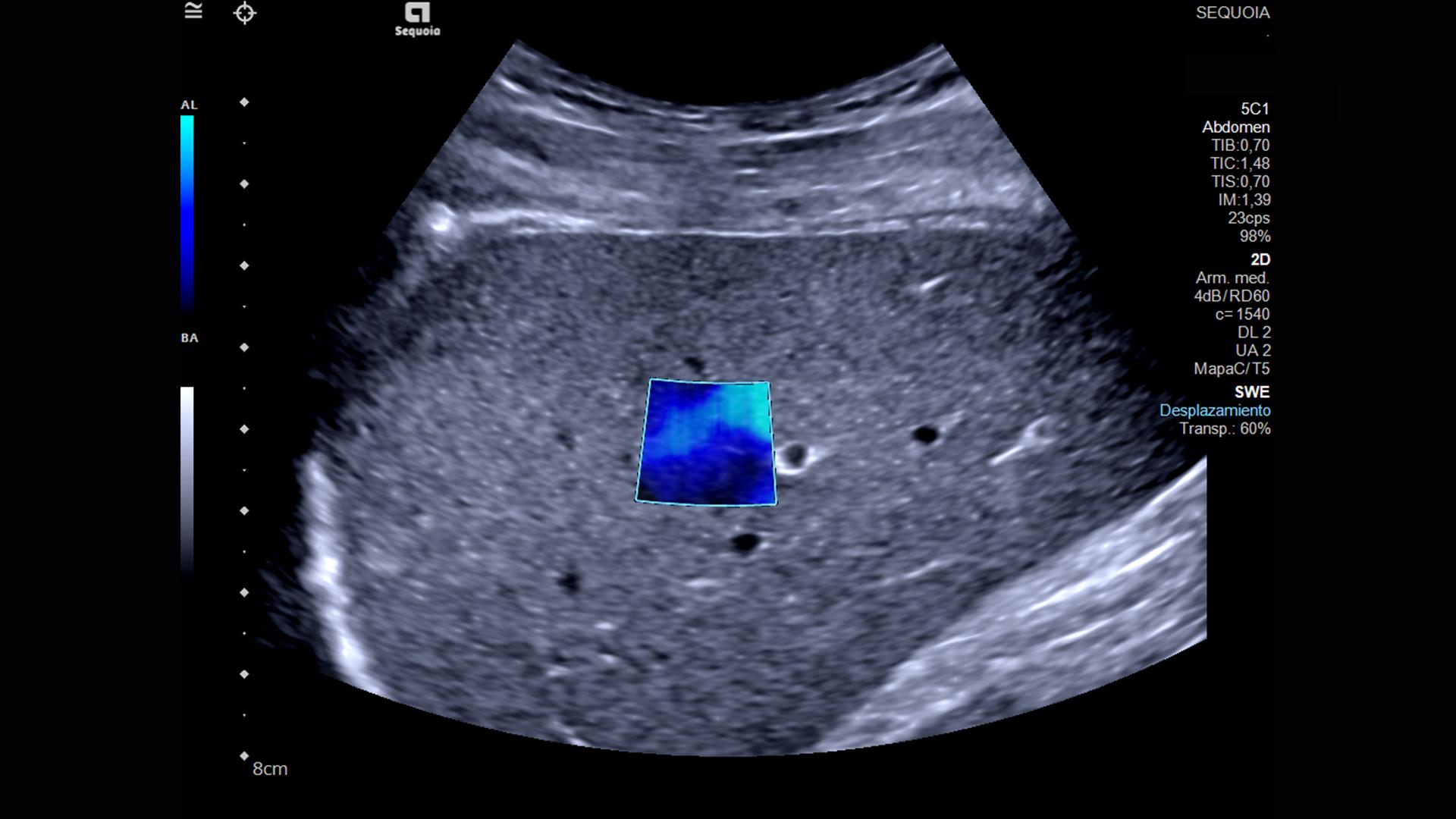 Personalized Ultrasound Solutions - Siemens Healthineers