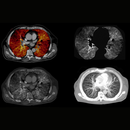 SOMATOM X.cite with myExam Companion - Siemens Healthineers USA