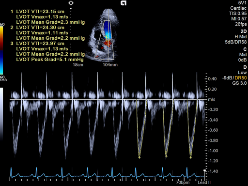 ACUSON Sequoia Ultrasound System - Siemens Healthineers USA