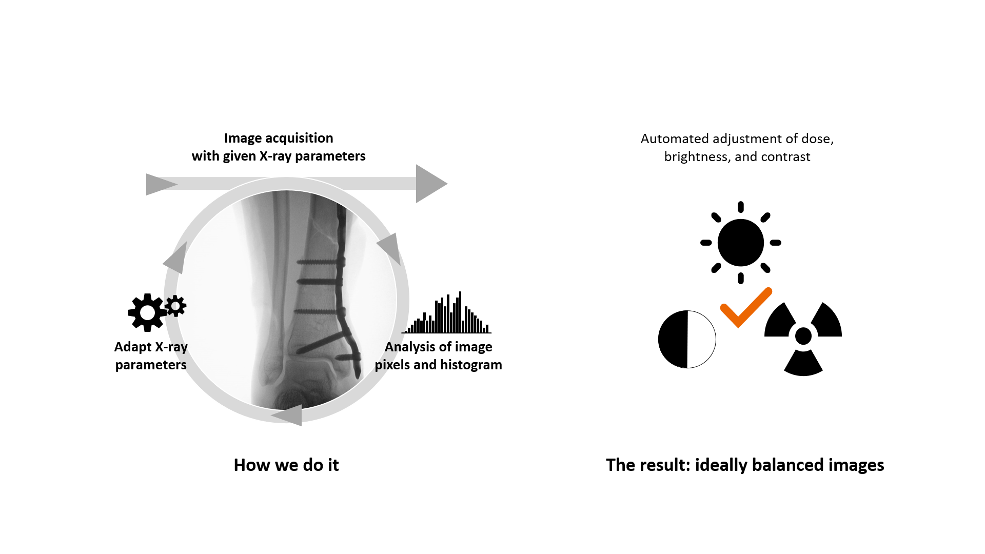 Mobile C-arm machine - Cios Select - Siemens Healthineers India
