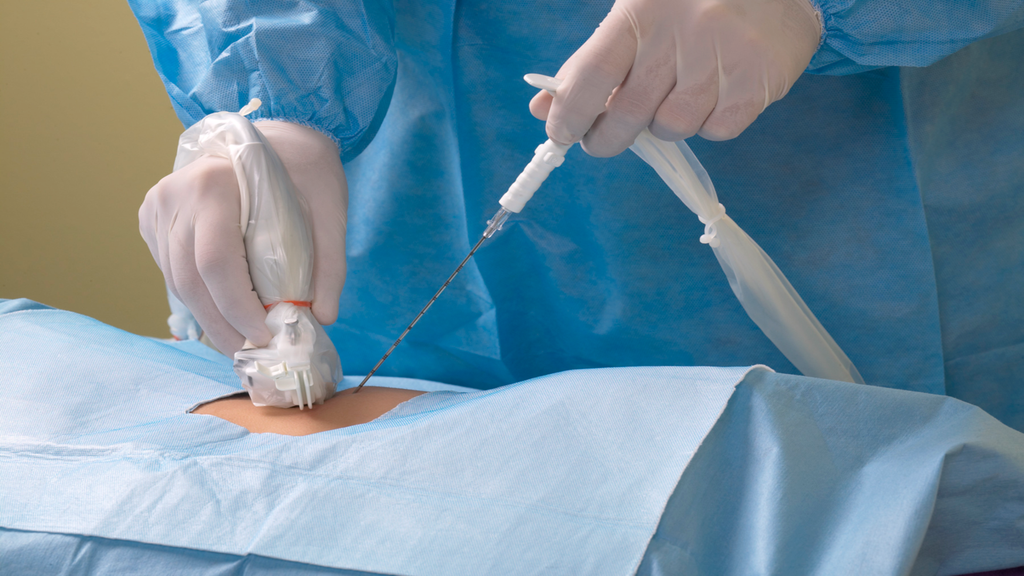 Liver Cancer Management - Siemens Healthineers