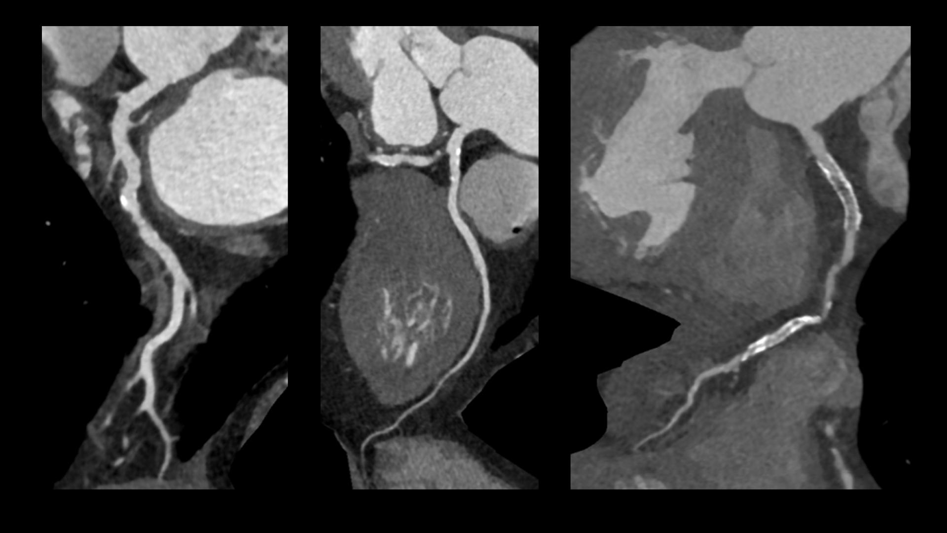 SOMATOM go.Top – Made to match - Siemens Healthineers