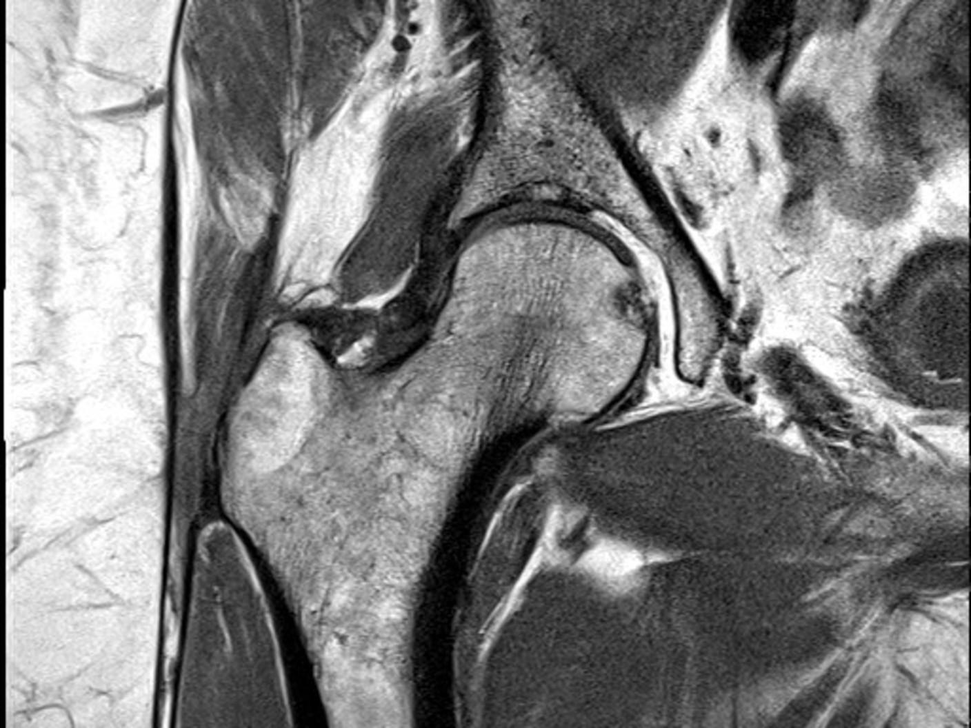 Coronal T1 SE-MAGNETOM Vida - Siemens Healthineers USA