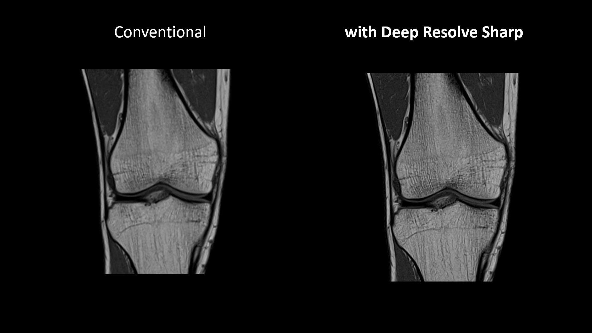 MAGNETOM Free.Max–wide bore mri - Siemens Healthineers