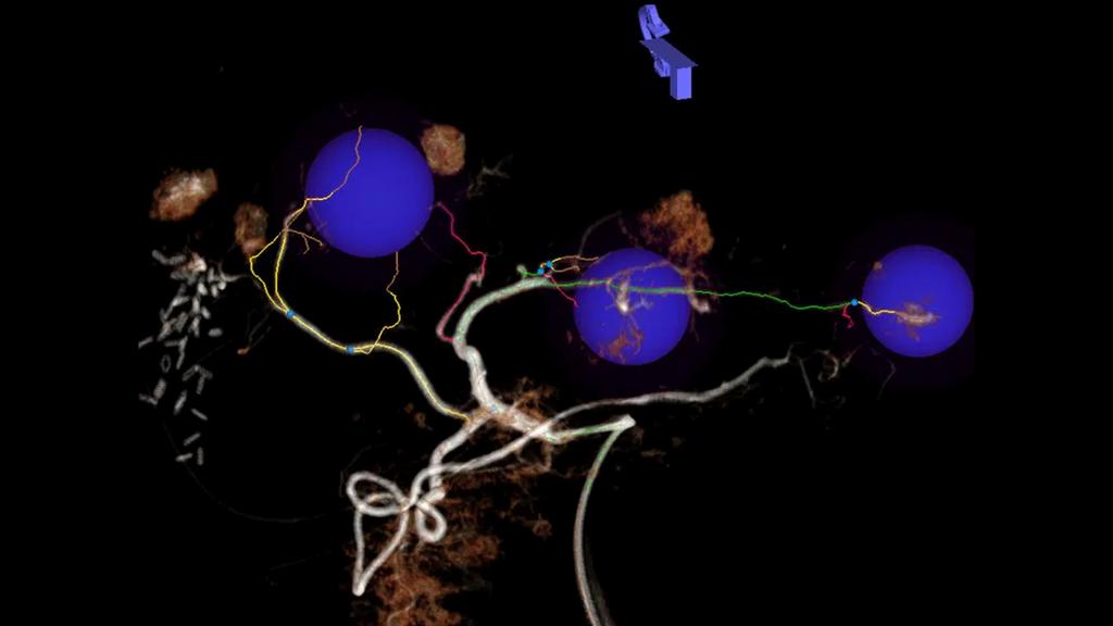 syngo DynaCT - Siemens Healthineers USA